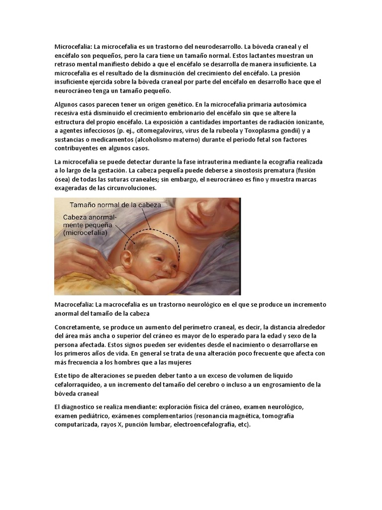 Embriologia Pregunta 3 Microcefalia Macrocefalia Hidrocefalia | PDF | Cráneo | Medicina