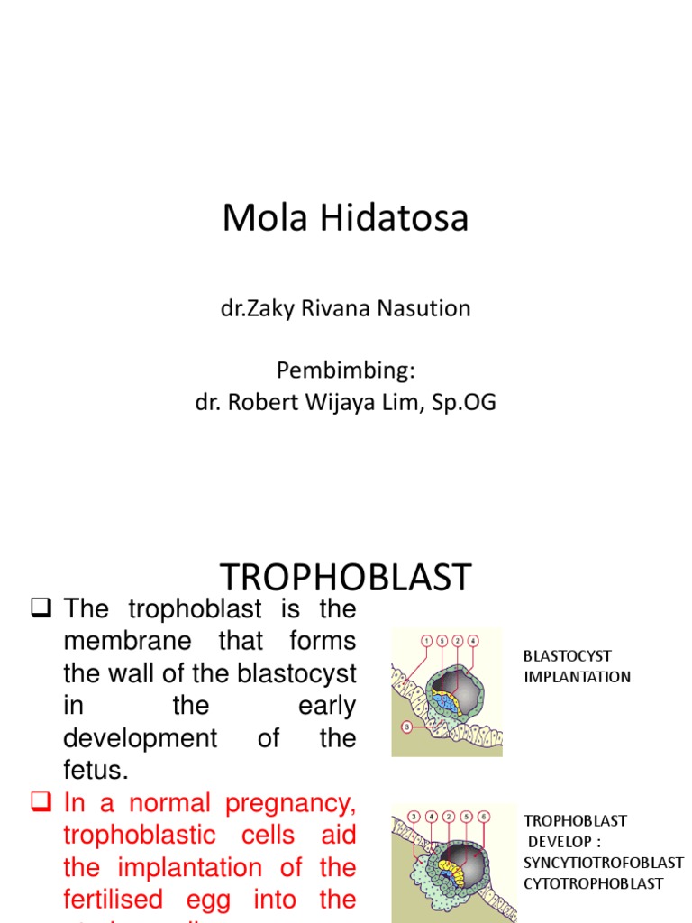 Mola Hidatidosa | PDF | Women's Health | Clinical Medicine