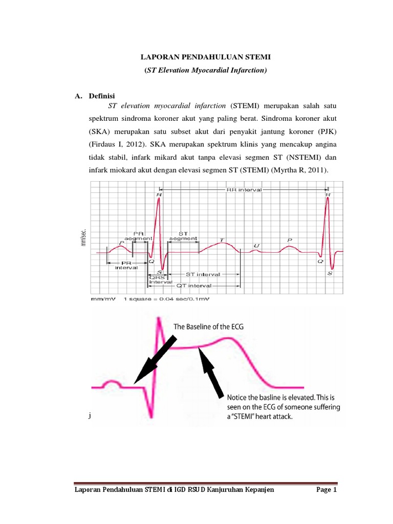 LP Stemi | PDF