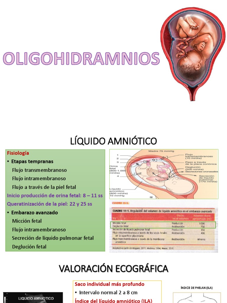 OLIGOHIDRAMNIOS | PDF | El embarazo | Parto