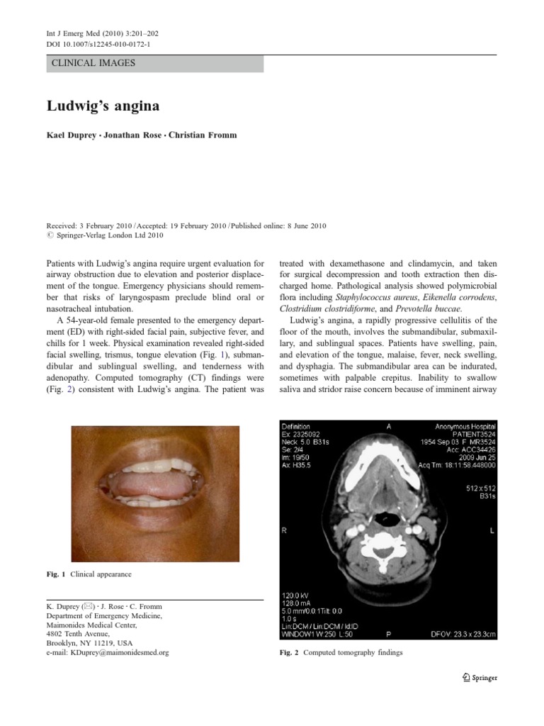 Ludwig 'S Angina: Clinical Images | PDF | Ct Scan | Clinical Medicine