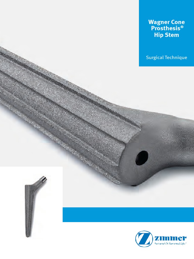 Wagner Cone Prosthesis Hip Stem Surgical Technique PDF | PDF | Hip ...