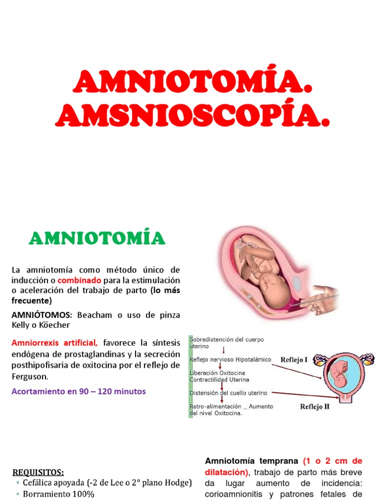 AMNIOTOMÍA | PDF | Parto | El embarazo
