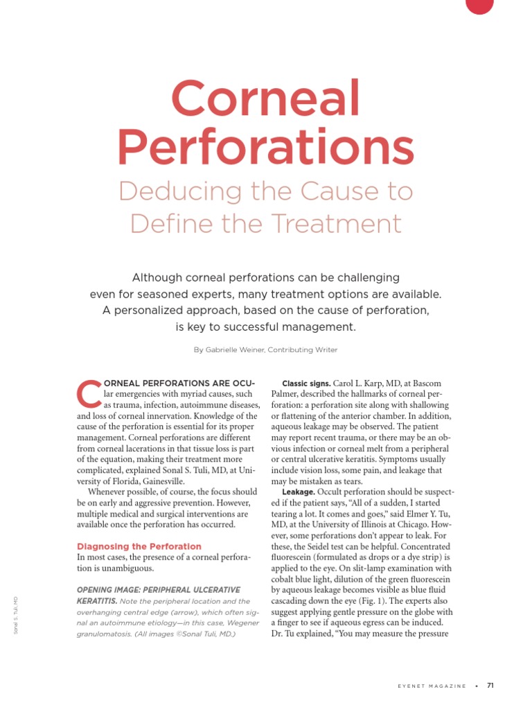 Eyenet 10 2016 Corneal Perforations | PDF | Cornea | Ophthalmology