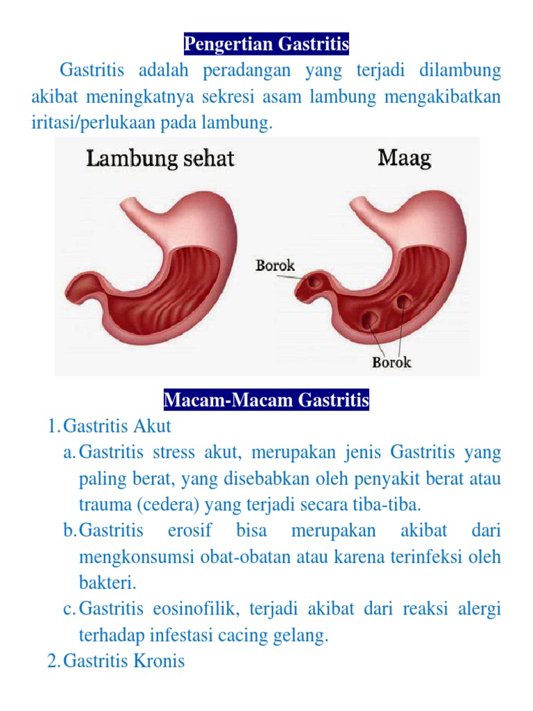 Pengertian Gastritis | PDF | Memasak, Makanan, & Anggur | Kesehatan ...