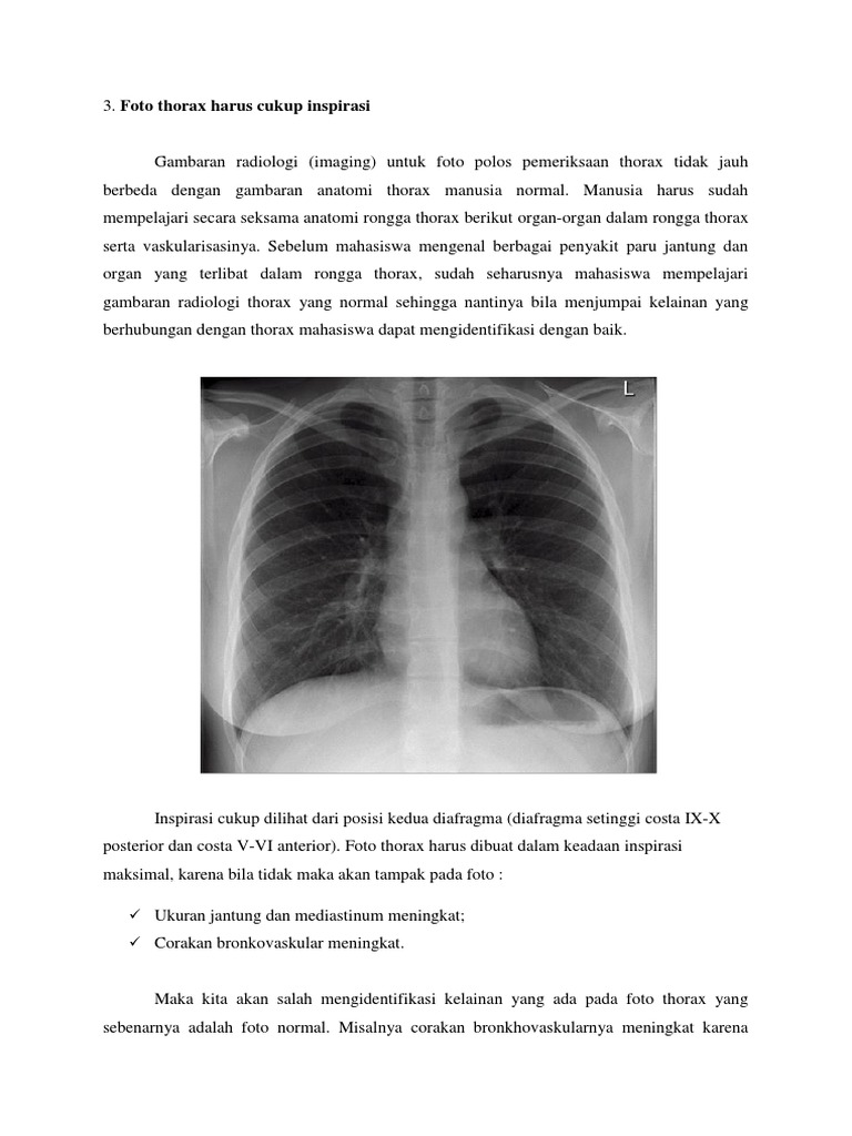 Pentingnya Inspirasi dalam Foto Thorax | PDF | Sains & Matematika