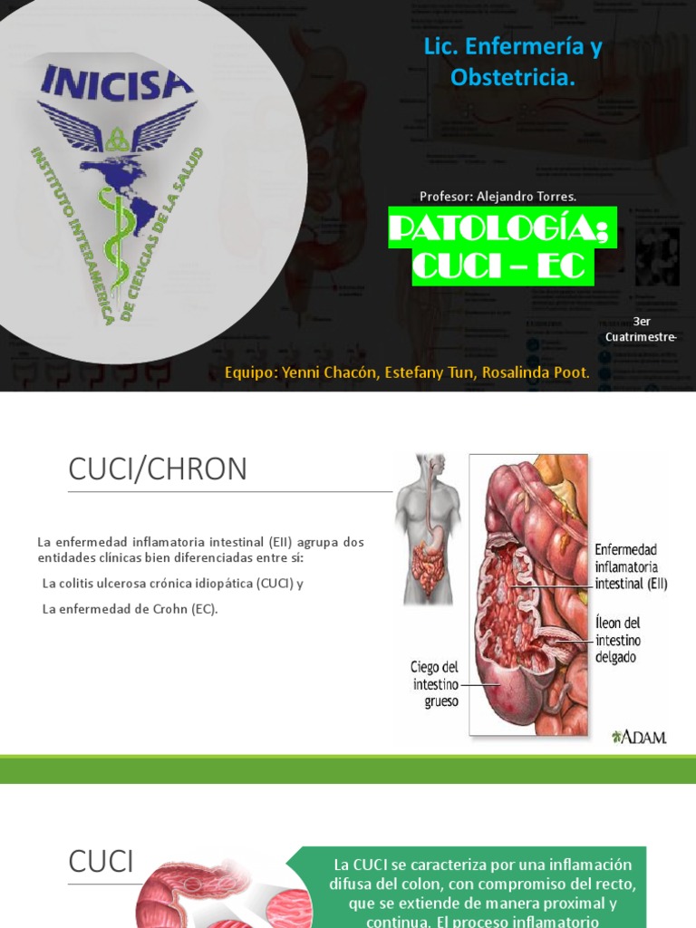 Diagnóstico y tratamiento de CUCI | PDF | Especialidades Medicas ...