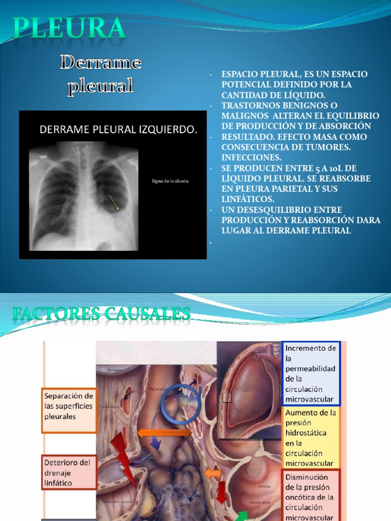 Pleura y Mediastino | PDF | Especialidades Medicas | Enfermedades y trastornos