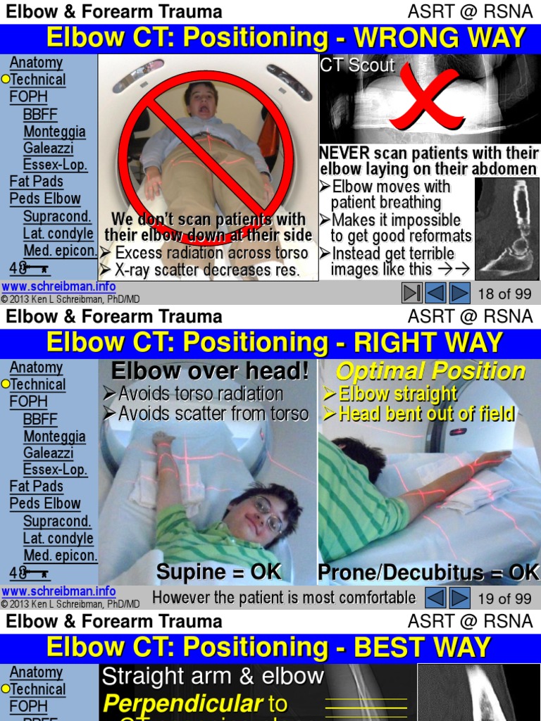 CT Elbow Handout | PDF | Elbow | Ct Scan