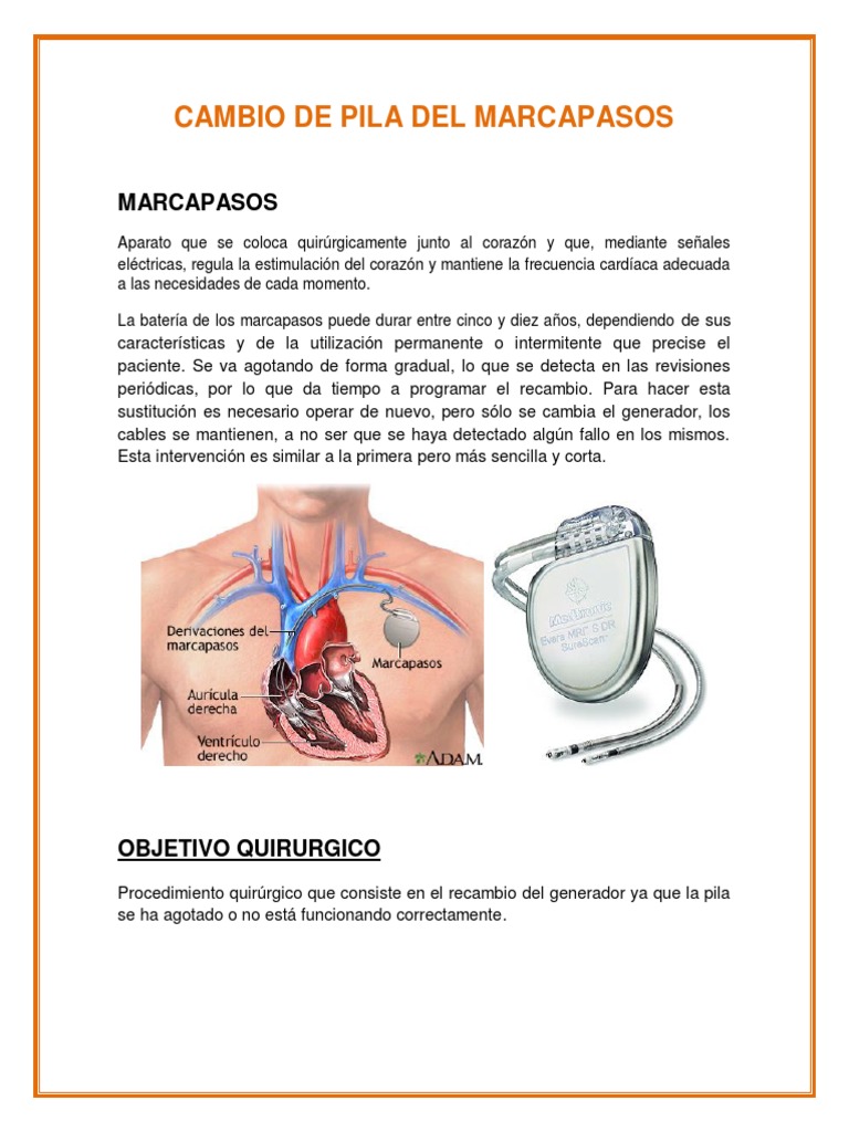 Cambio de Pila Del Marcapasos | PDF | Marcapasos cardíacos artificiales ...
