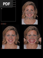 DSD Template PowerPoint | PDF