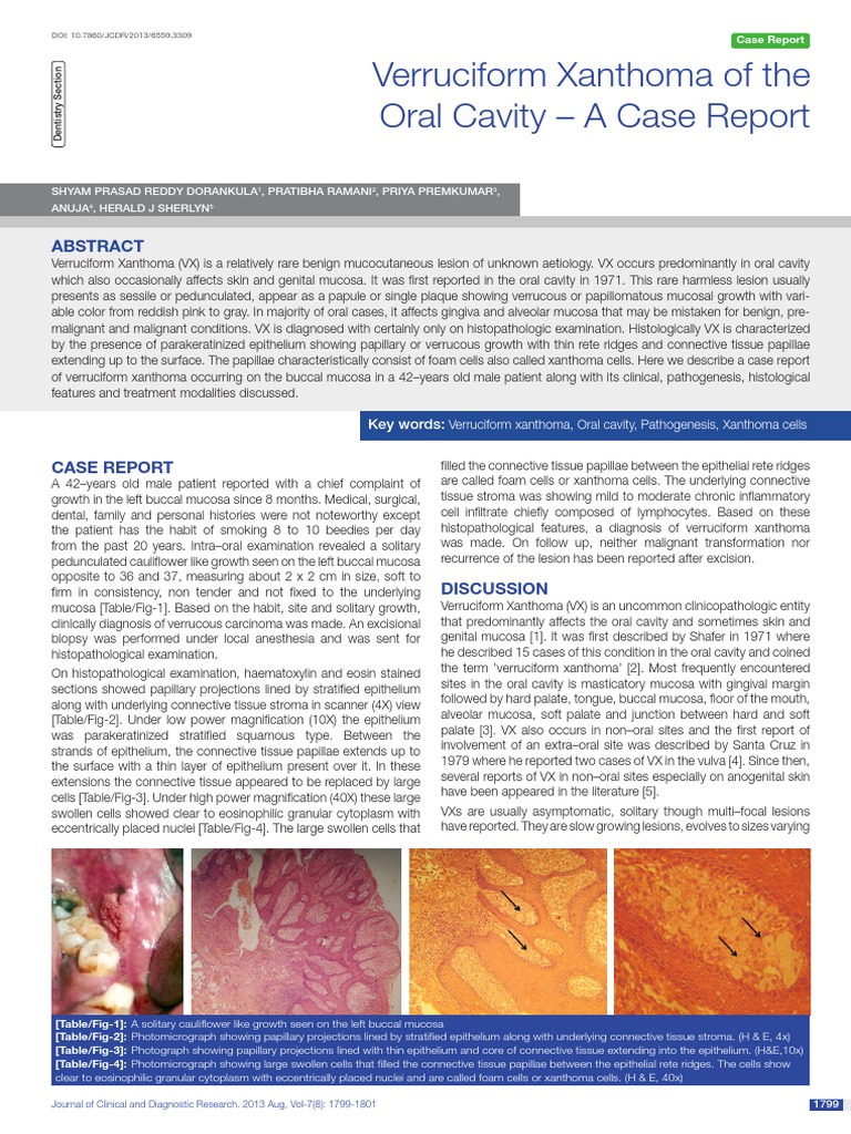 Verruciform Xanthoma of The Orall Cavity | PDF | Epithelium | Medical ...