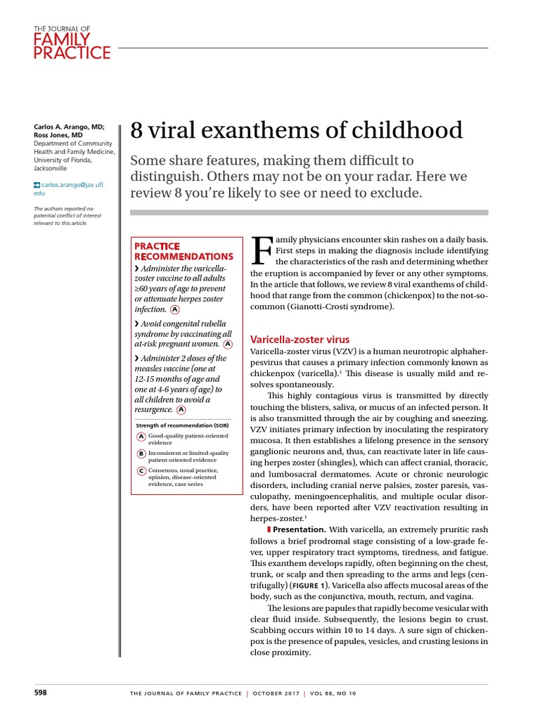 Viral Exanthems of Childhood: A Review of 8 Common Rashes Including ...