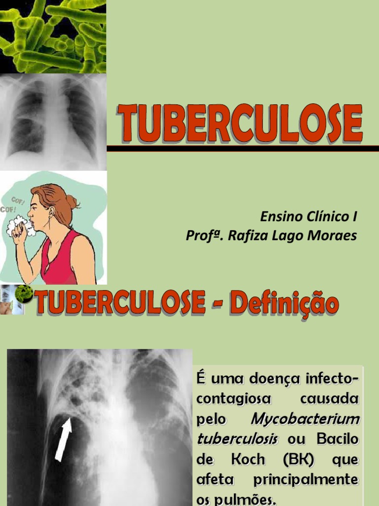 Aula 7 Tuberculose PDF | Download grátis PDF | Mycobacterium ...