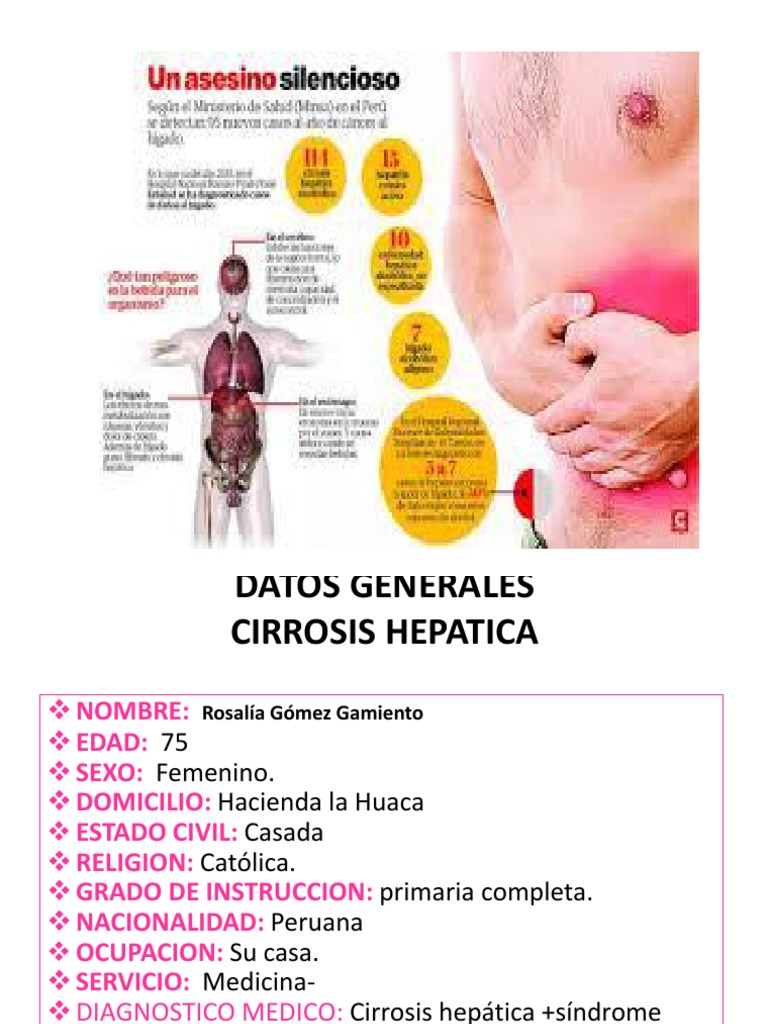 Cirrosis Hepatica | PDF | Cirrosis | Especialidades Medicas