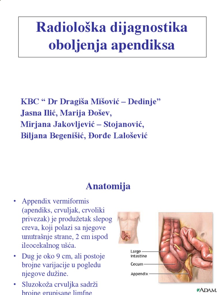 Radiolo - Ka Dijagnostika Oboljenja Apendiksa, Definitivna Vezija Prezentacije | PDF
