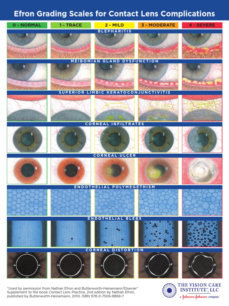 Efron Grading Scale Us Insert | PDF | Science & Mathematics