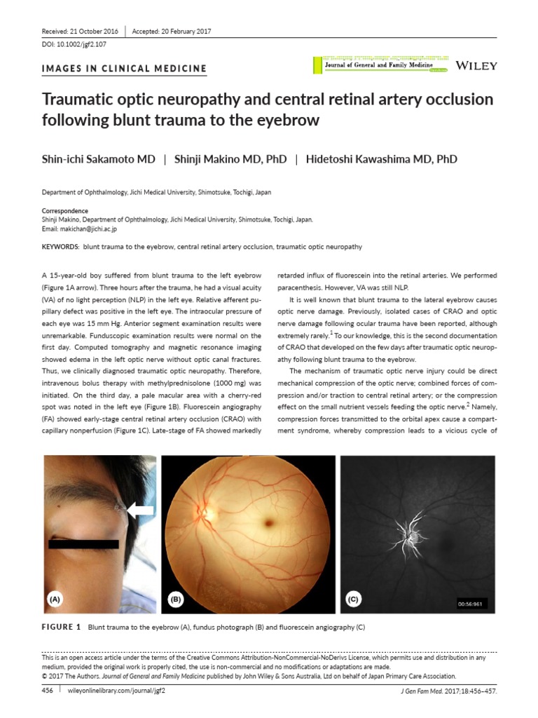 Traumatic Optic Neuropathy and Central Retinal Artery Occlusion ...