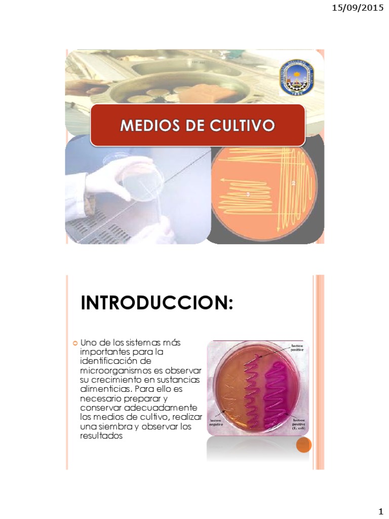 Medios de Cultivo Ppt 2015 | Medio de crecimiento | Química