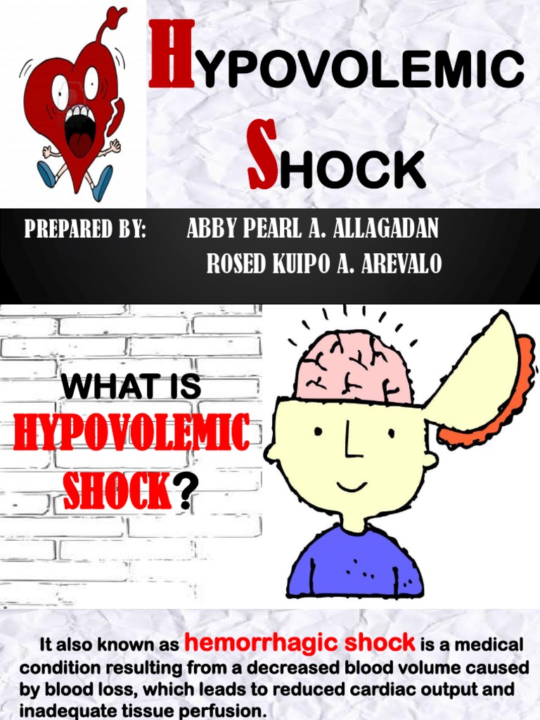Hypovolemic Shock | PDF | Shock (Circulatory) | Bleeding
