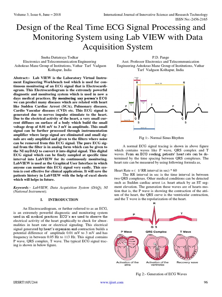 Design of The Real Time ECG Signal Processing and Monitoring System Using Lab VIEW With Data ...