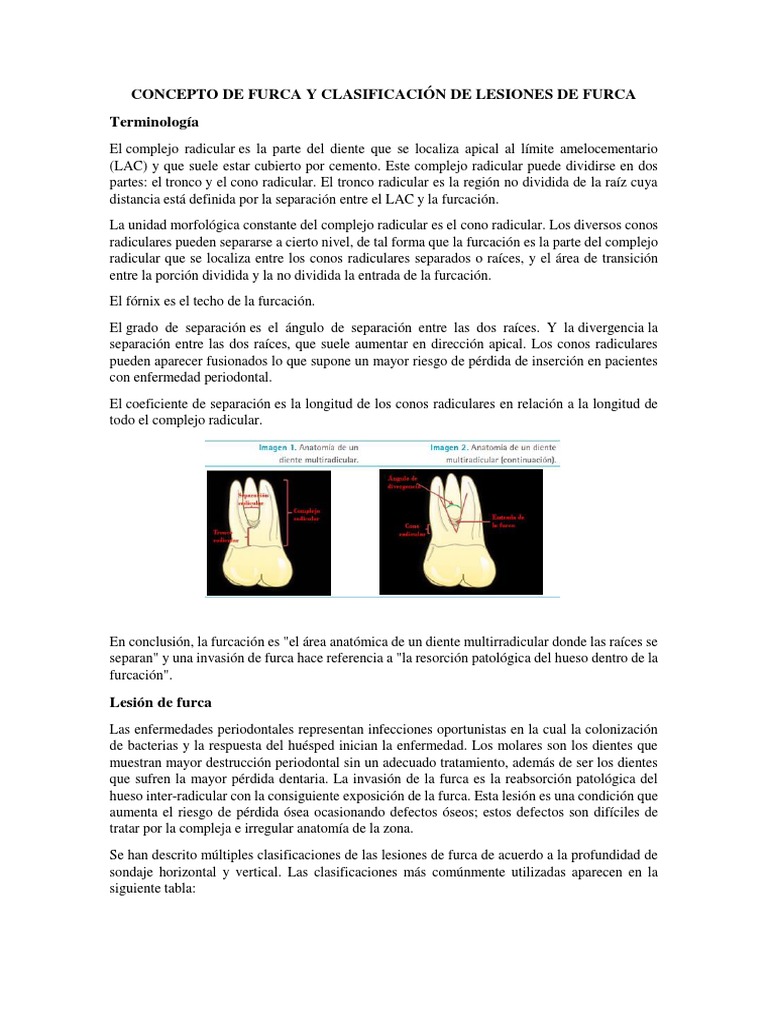 Concepto de Furca y Clasificación de Lesiones de Furca | PDF ...