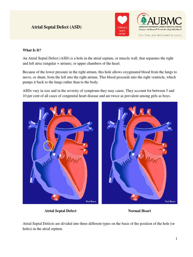 Atrial Septal Defect | PDF | Atrium (Heart) | Heart