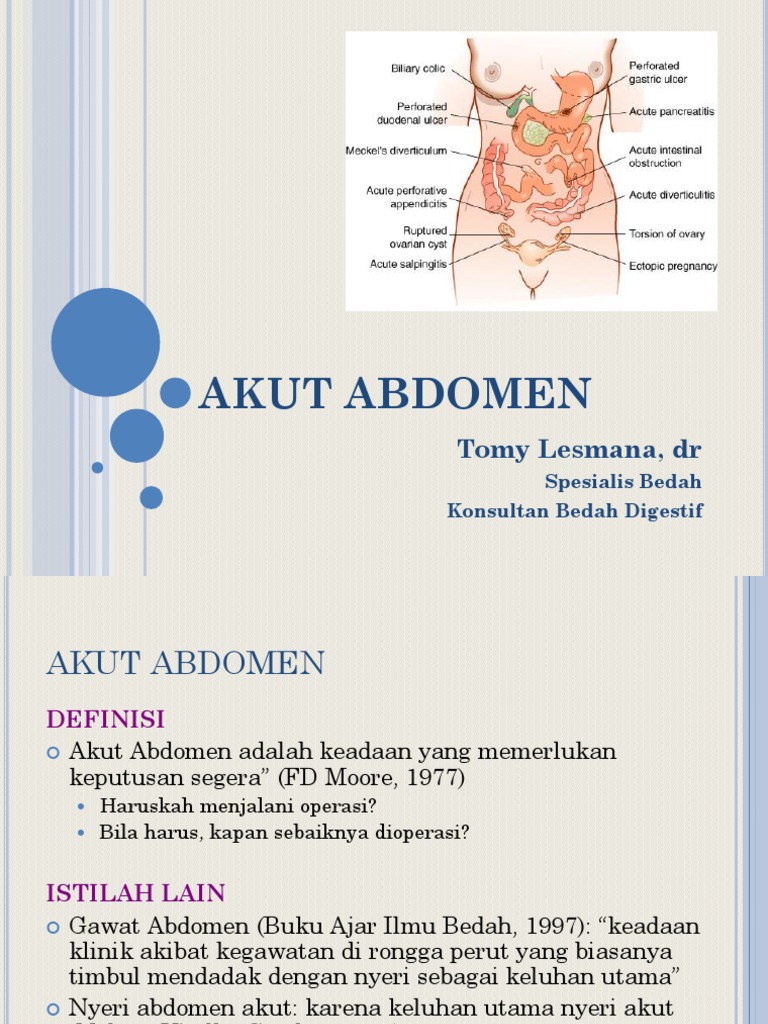 Akut Abdomen Tomy 2015 | PDF