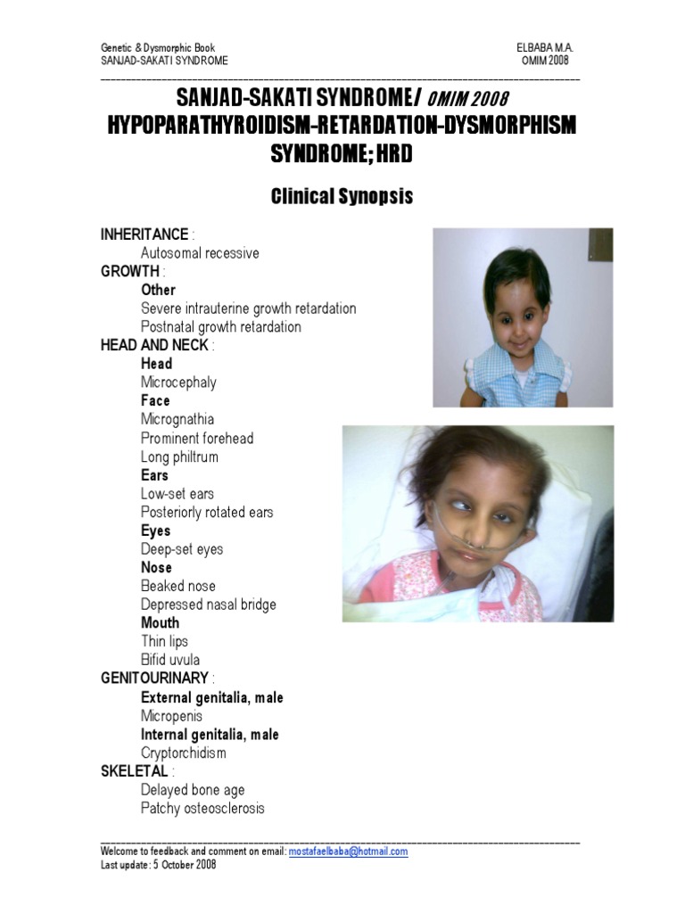 Sanjad-Sakati Syndrome Overview | PDF