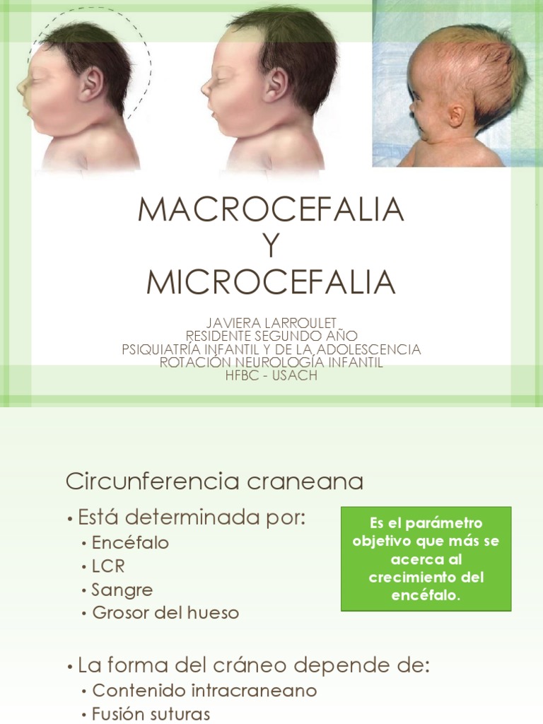 Macro y Microcefalia JL | PDF | Desórdenes neurológicos | Enfermedades ...