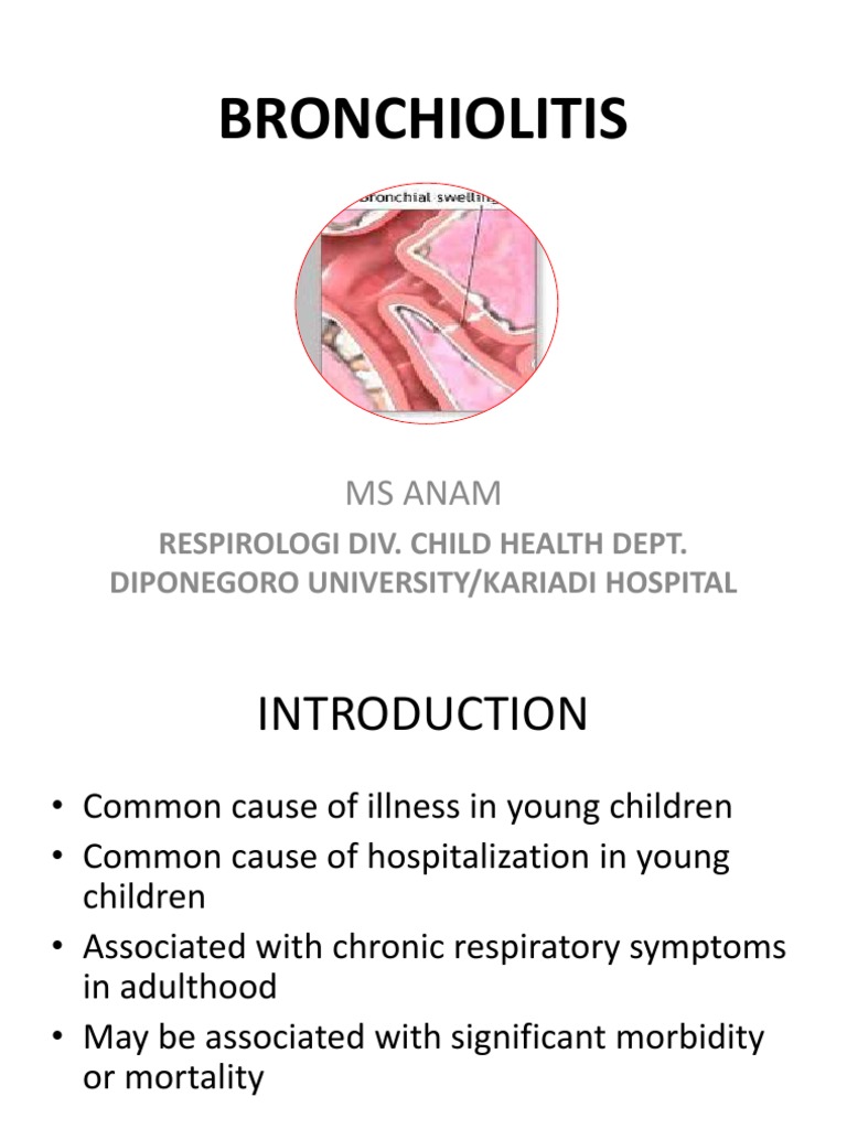 Bronchiolitis: Ms Anam | PDF | Immunology | Epidemiology