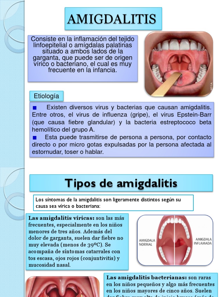 Amigdalitis, Faringitis, Parotiditis | Epidemiología | Especialidades ...