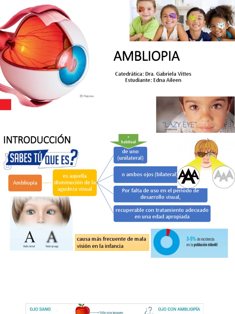 Ambliopia - Oftalmología | PDF | Enfermedades del ojo y anexos | Visión