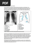 Anatomi Thorax Normal + Gambaran Radiologi | PDF