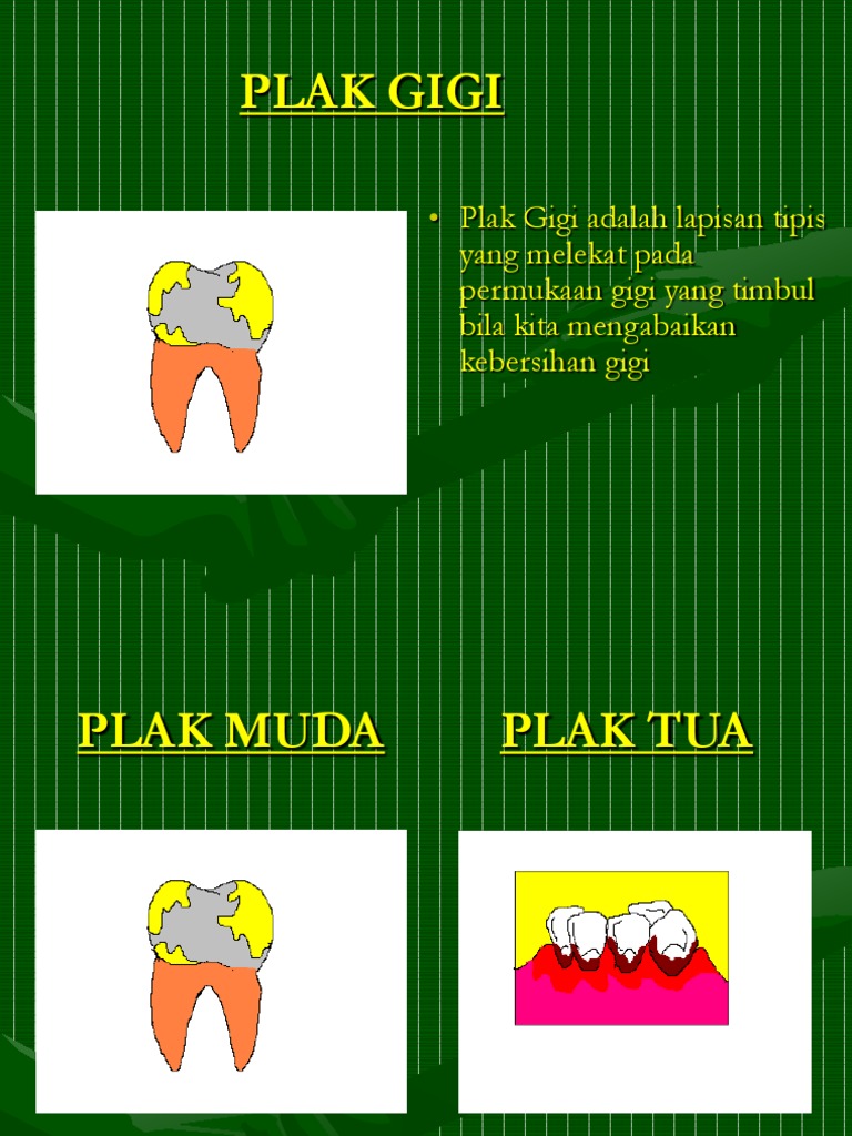 PLAK | PDF