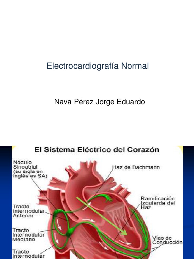 Electro Normal | PDF | Electrofisiologia | Electrocardiografia