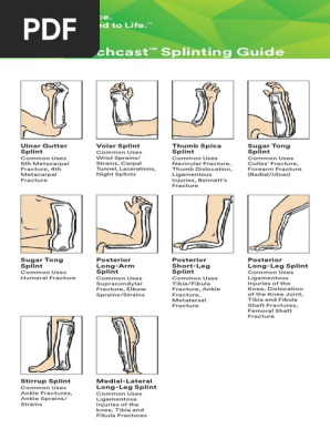 Splinting Guide, 54% OFF | www.oceanproperty.co.th
