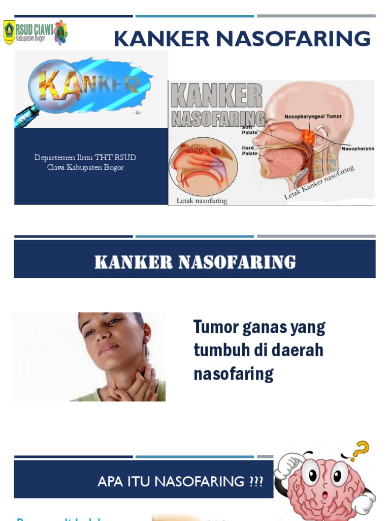 Penyuluhan PPT CA Nasofaring | PDF