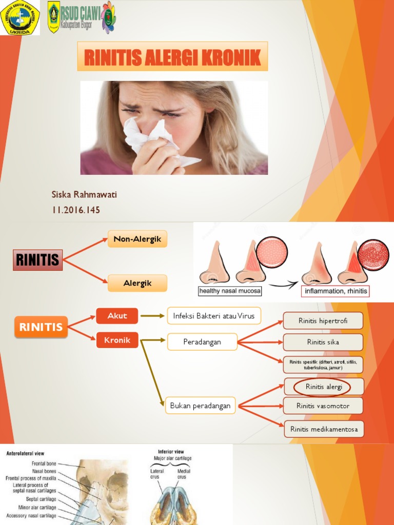 Rinitis Alergi Kronik | PDF