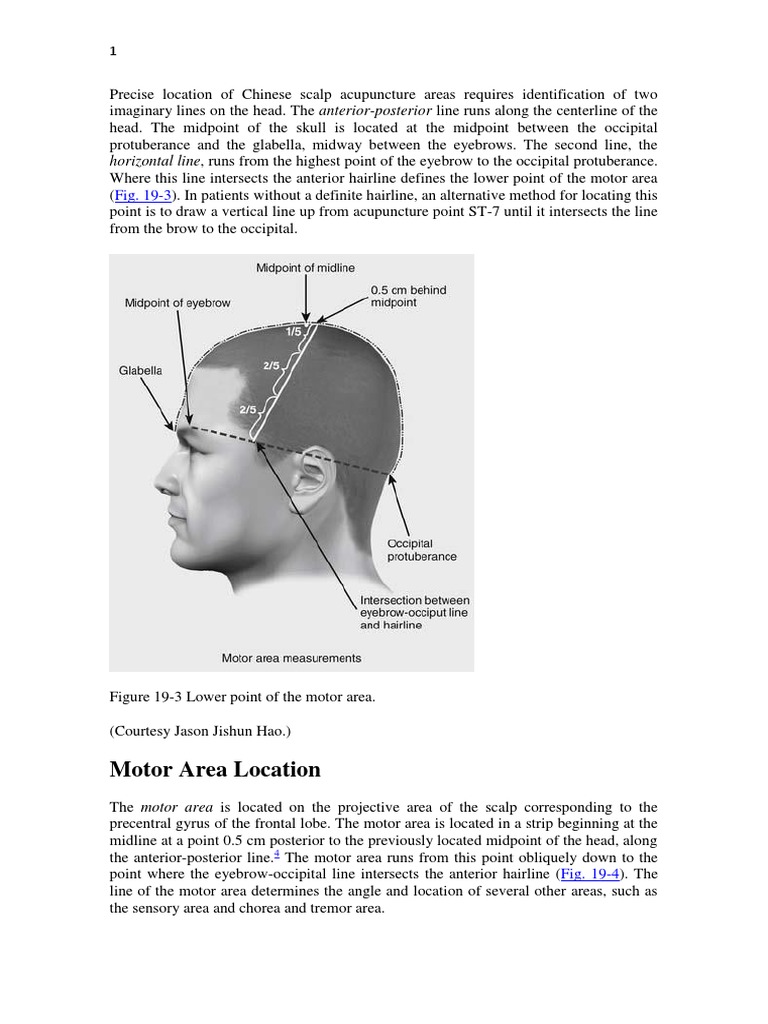 Scalp Acupuncture Motor Area Guide | PDF | Stroke | Occipital Lobe