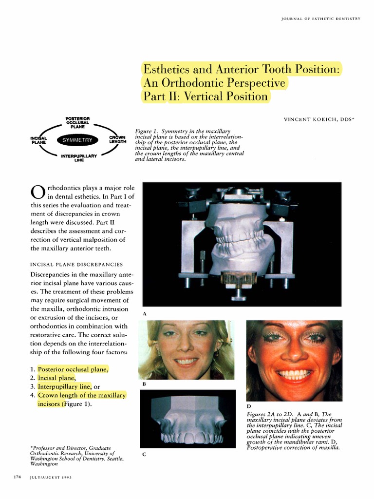 Kokich 2 | PDF | Orthodontics | Mouth