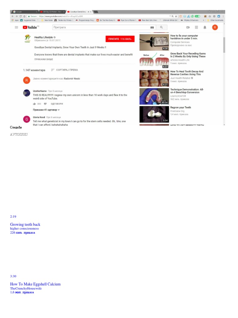 How To Heal Tooth Decay and Reverse Cavities Using This Easy Remedy ...