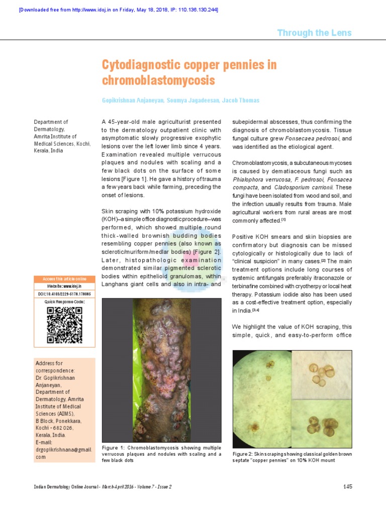 Cytodiagnostic Copper Pennies in Chromoblastomycosis: Through The Lens ...