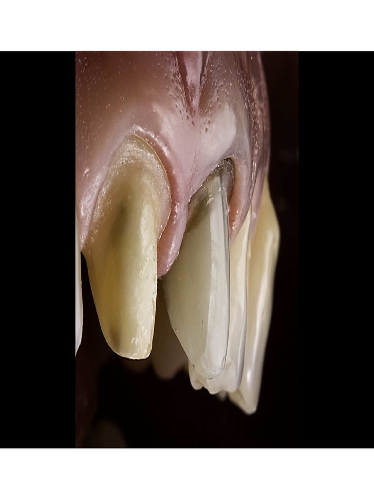 Sellado Inmediato de La Dentina | Diente | Anatomia dental