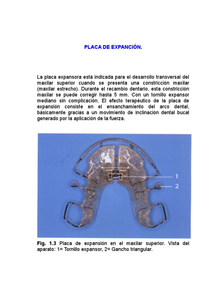 Placa de Expanción 4 | PDF