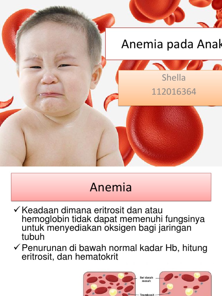 Ciri dan Penyebab Anemia pada Anak | PDF