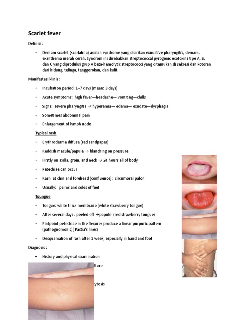 Scarlet Fever | PDF