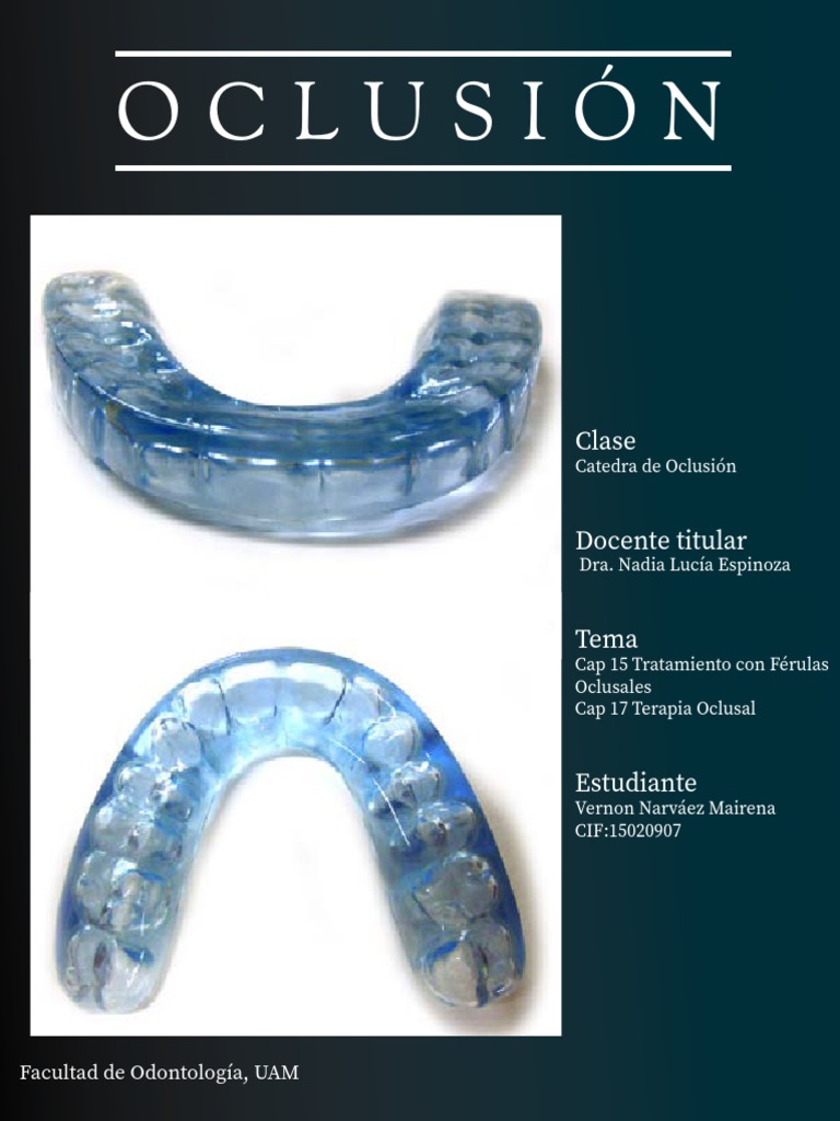 Férulas y Tratamiento Oclusal | Ortodoncia | Odontología