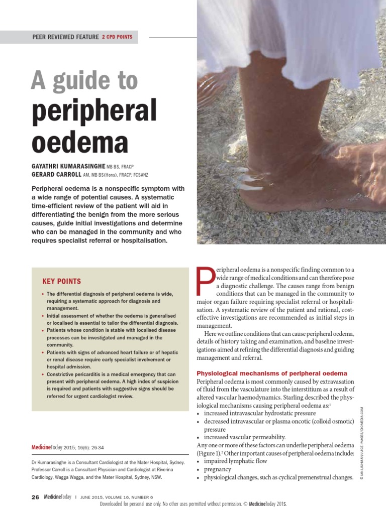 Peripheral Edema Definition | Oedème Périphérique Définition – GMLYP