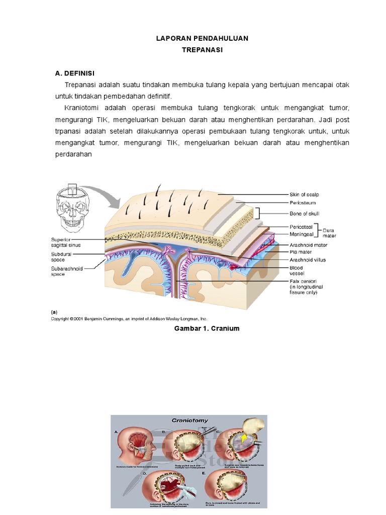 Trepanasi: Definisi, Indikasi, dan Teknik Operasi | PDF